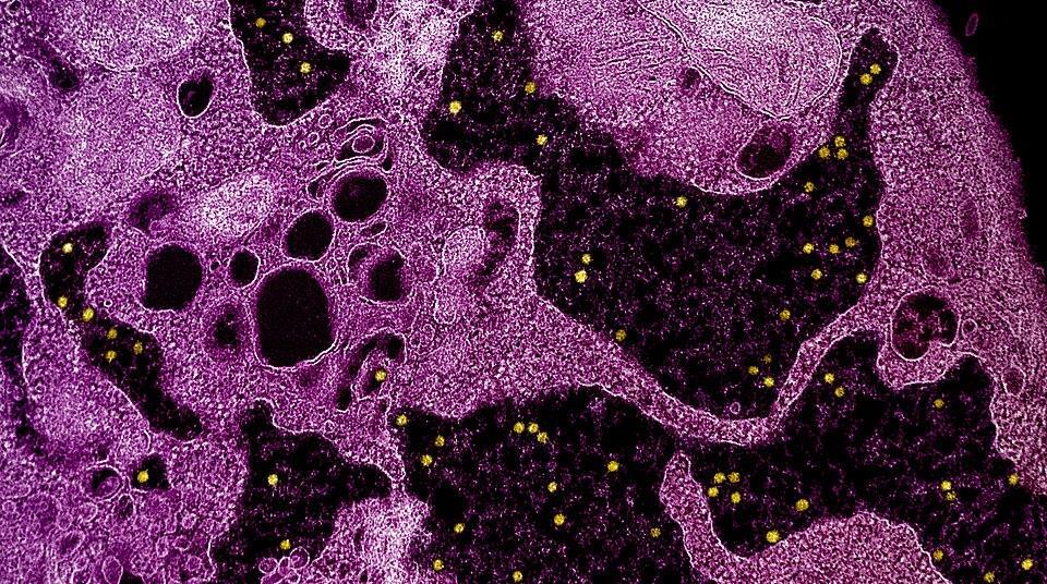 Yellow fever vaccination: how strong immune responses are triggered ...