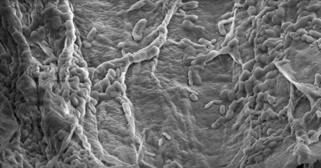 Thar desert rhizobacterium offers potential as green biofertilizer that ...