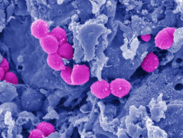 Research uncovers new strategy to reduce tissue damage from flesh ...