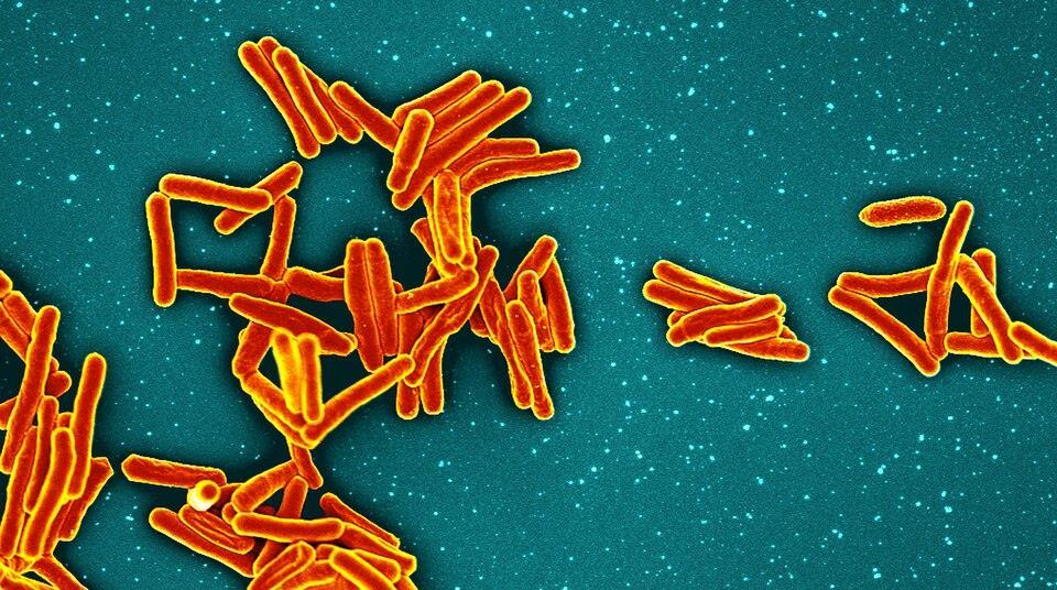 TB harnesses part of immune defense system to cause infection | News ...