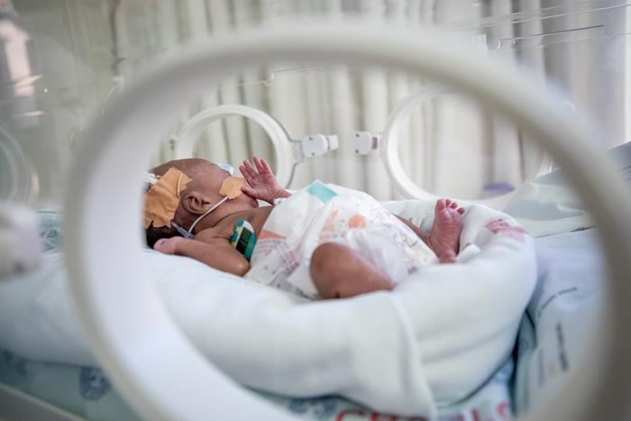 Trial aims to improve treatment for newborns with sepsis | The ...