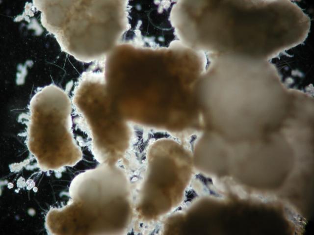 Scientists uncover how gadolinium and sulfamethoxazole impact ...