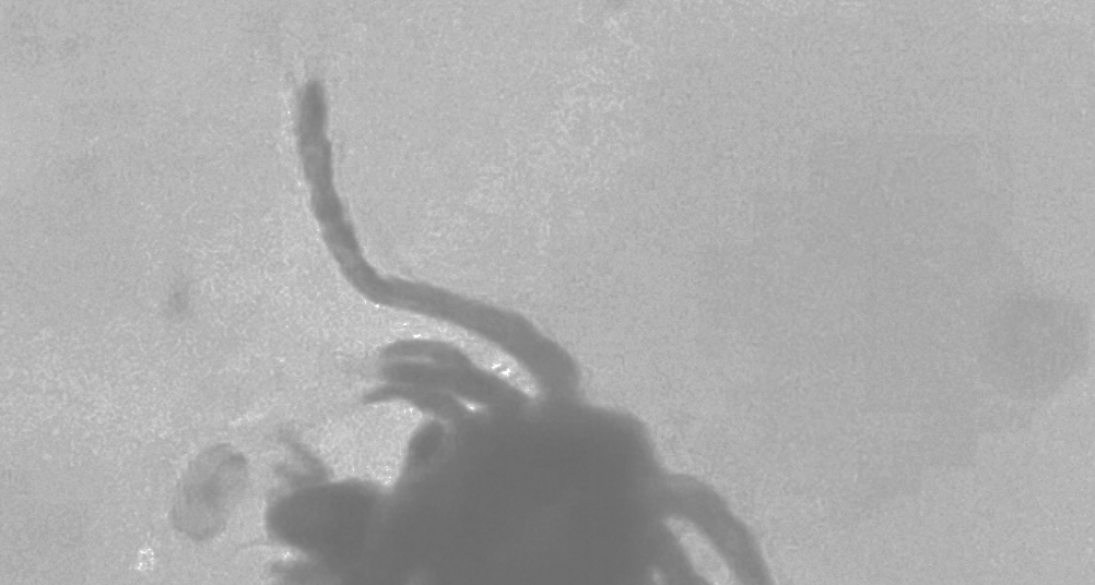 Zooplankton go ‘Eew!’ to cleaning feces-contaminated water | News | The ...