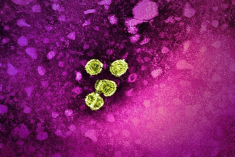 Scientists unveil hepatitis B virus core protein as a Rab-GAP ...