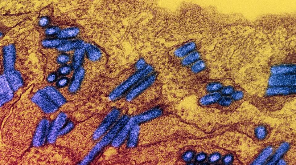 Missing links for rabies in Peru highlights global threats of health ...