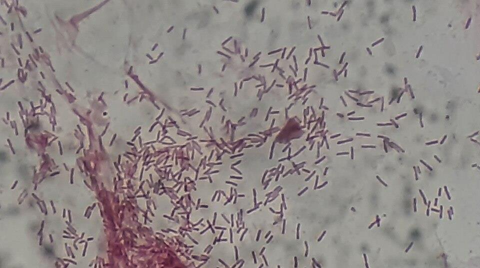 A gentler way to model deadly lung infections in old age | News | The ...