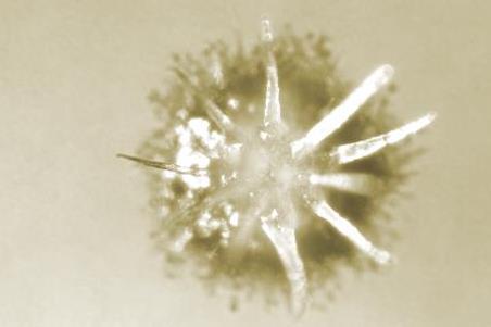 Microbial slime layer can be unlocked with oxalic acid | The Microbiologist