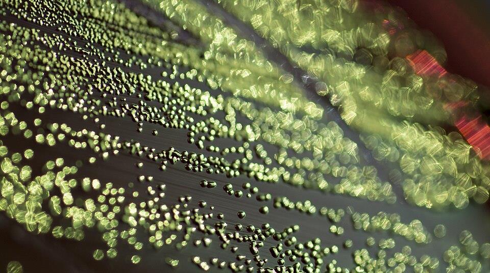 Research reveals hidden diversity of E. coli driving diabetic foot ...