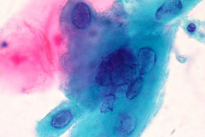 Study explains why virus causing cold sores does not spread to ...