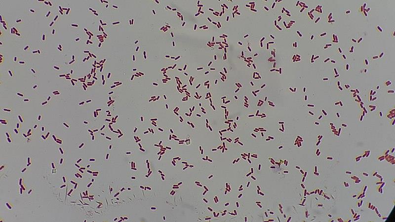 Infected bacteria fight back with ‘hidden’ genes that halt cell growth ...