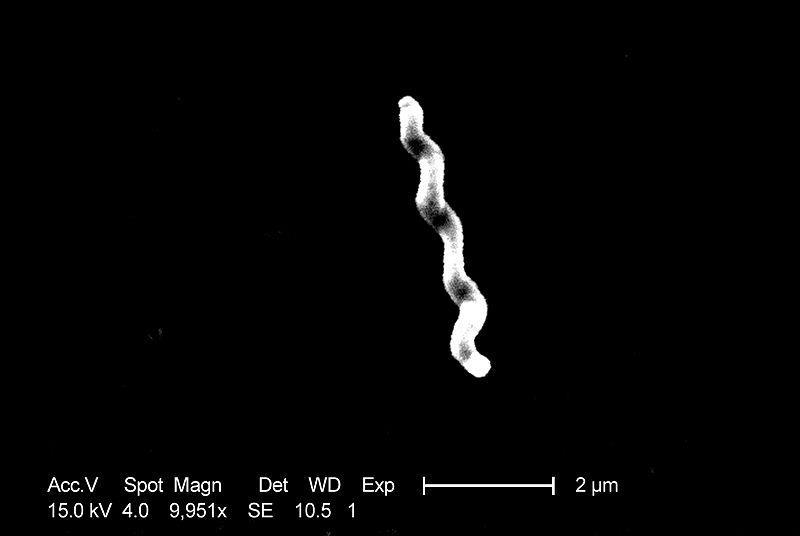 Common food poison toxin speeds colon cancer spread | News | The ...