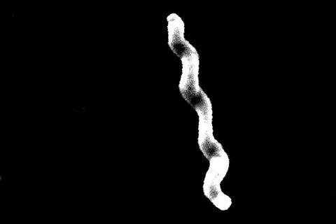 Common food poison toxin speeds colon cancer spread | News | The ...