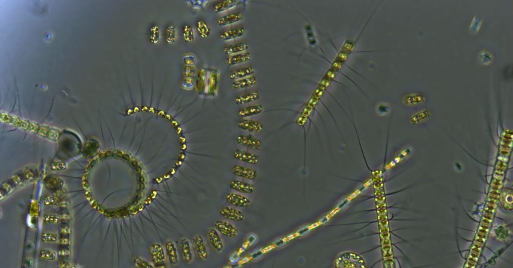 Under the microscope: microalgae-based bioremediation | Features | The ...