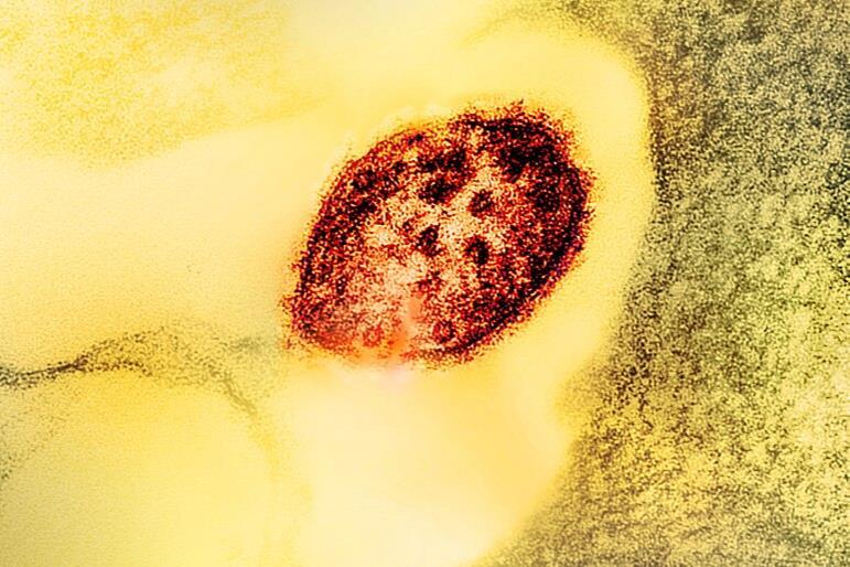Measles elimination versus eradication: The difference explained | News ...