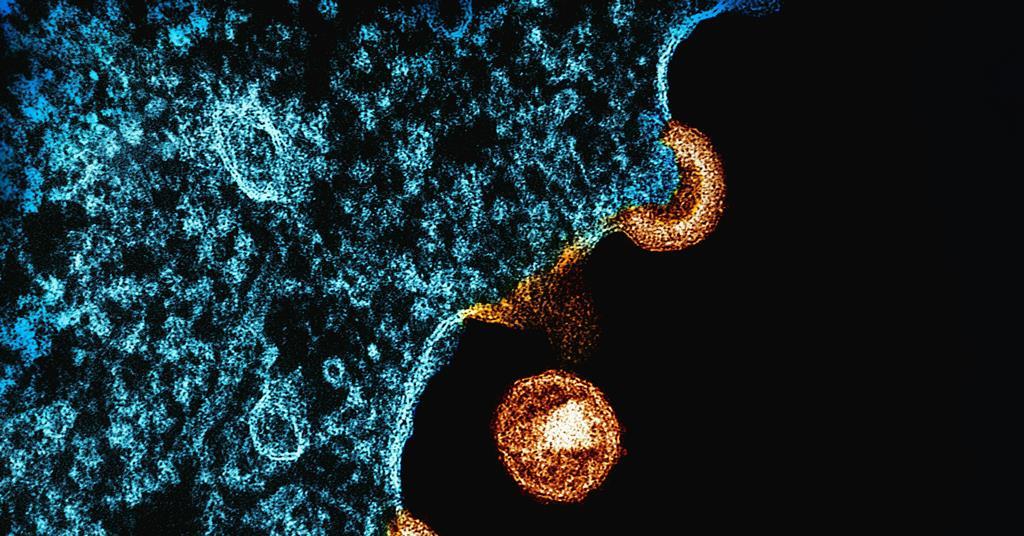 New HIV reporter model: Visualizing HIV viral dynamics in cells with ...