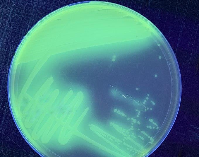 Researcher to study the arms race between bacteria and viruses | The ...