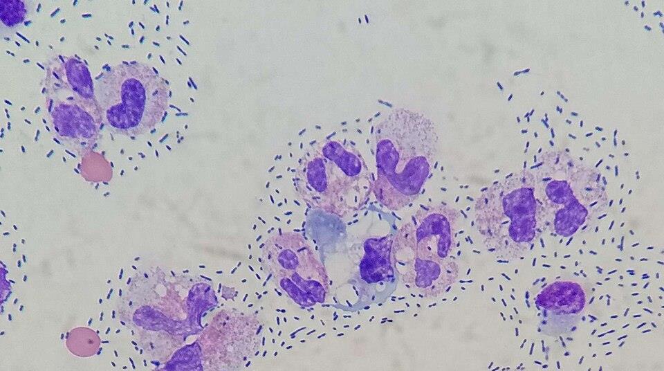 A non-invasive test enables accurate detection of infant meningitis ...