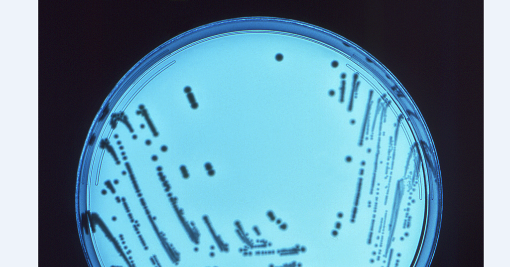 Vibrio toxins force key proteins to build ‘roads to nowhere’ | The ...