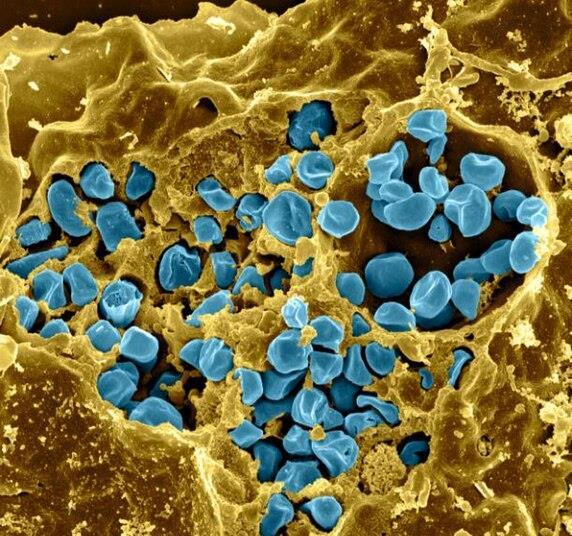 Study unveils structure, identification and characterization of the ...