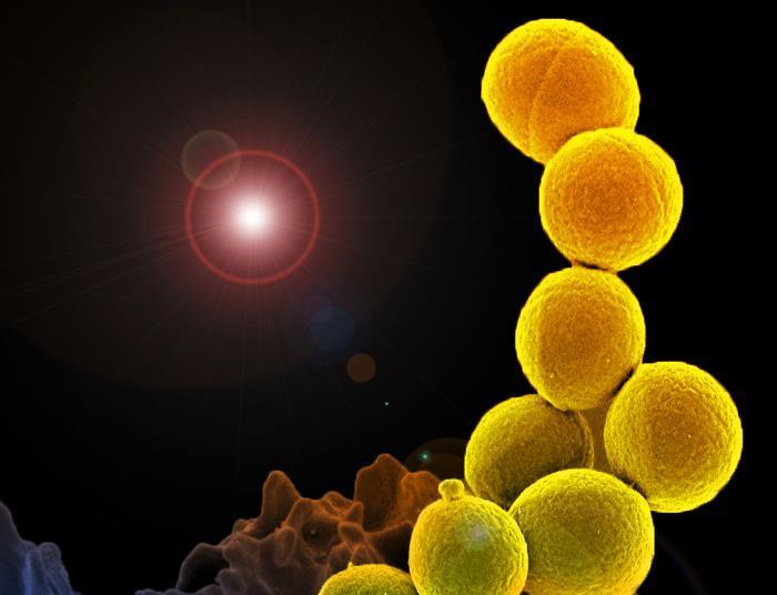 Researchers discover genes behind AMR in deadly superbug infections ...