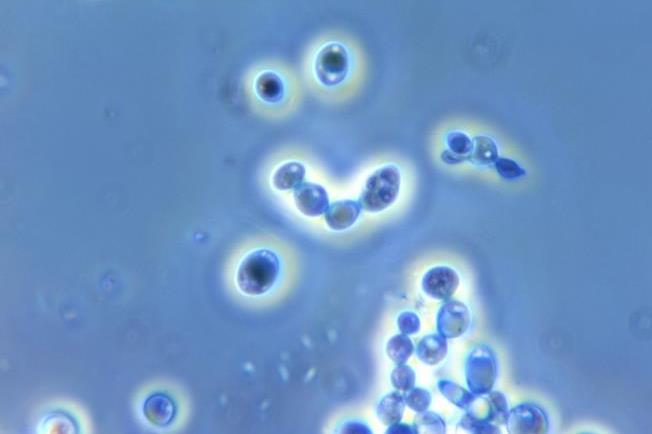 New molecular toolkit boosts useful molecule production from yeast ...
