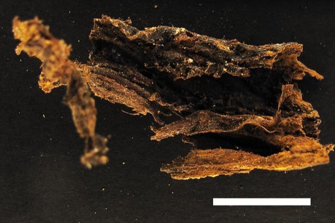 Malaria pathogen found in mummified soft tissue in Medici tomb | The ...