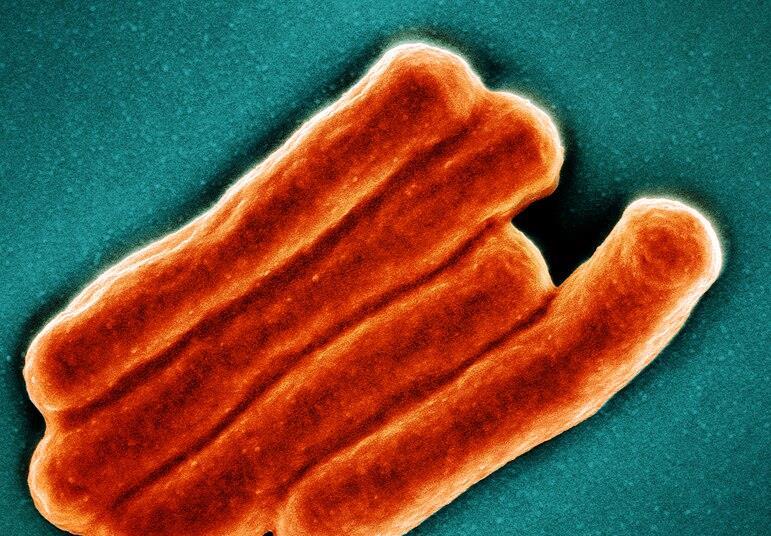 Recombinant protein offers potential as TB booster vaccine | News | The ...