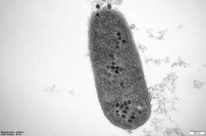 New collection of bacteria-eating viruses can tackle hospital superbug ...