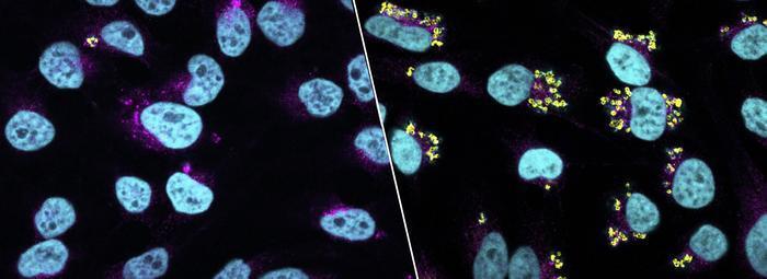 Research tool reveals how Golden staph hides in human cells | The ...
