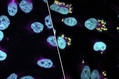Research tool reveals how Golden staph hides in human cells | The ...