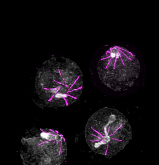 Disabling sensor halts malaria parasite in its tracks | The Microbiologist
