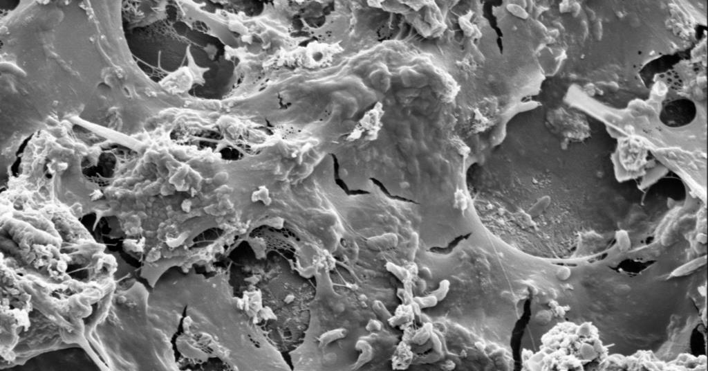 Clean water for all | Features | The Microbiologist