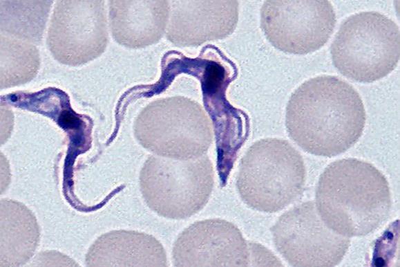 Chad eliminates human African trypanosomiasis as a public health ...