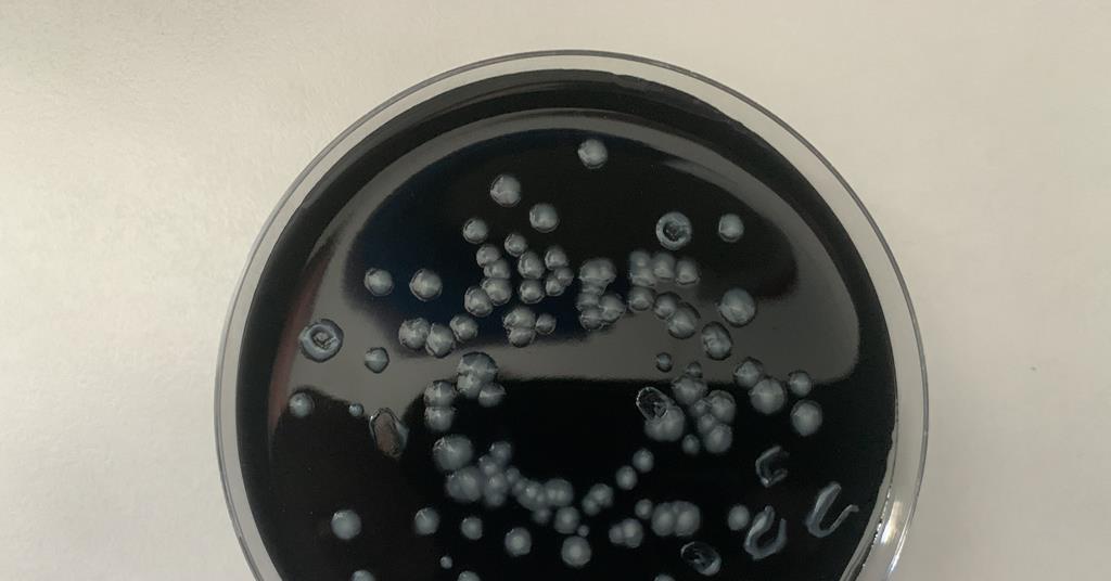Changing the culture of Legionella testing | Features | The Microbiologist
