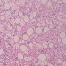 β-ionone shows promise in preventing ulcerative colitis through gut ...