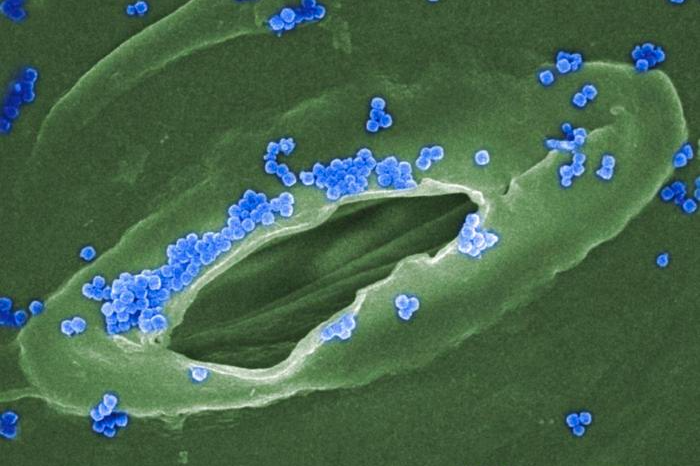 Nanoparticle smart spray helps crops block infection before it starts ...