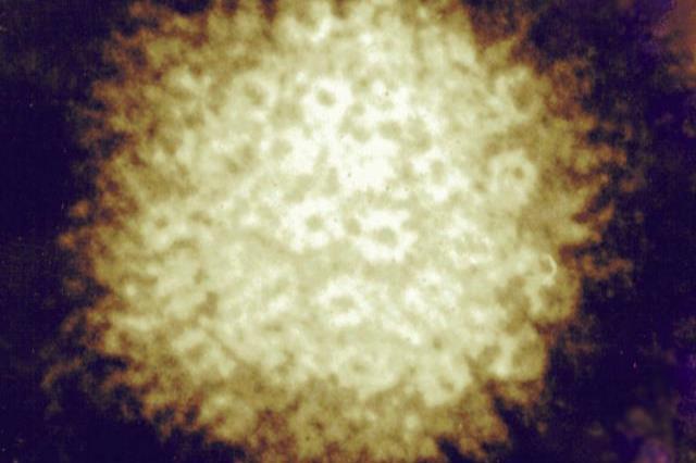 Long-term low-dose antiviral treatment benefits patients with eye ...