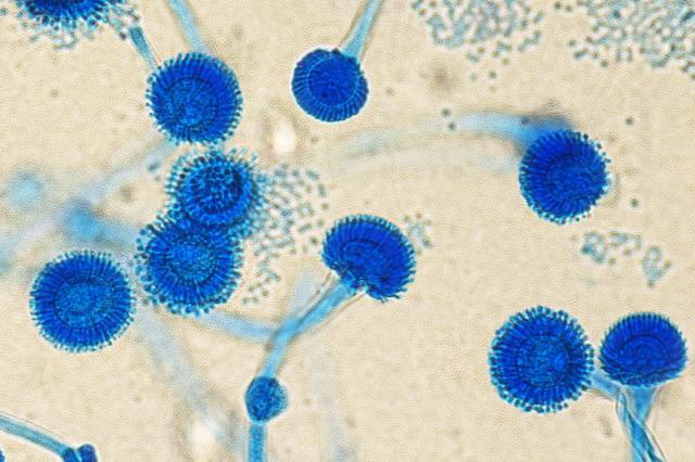 Deadly mould strains highly likely to acquire resistance to new drugs ...