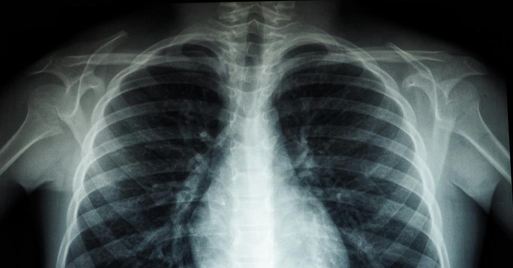 Corticosteroid use does not appear to increase infectious complications ...