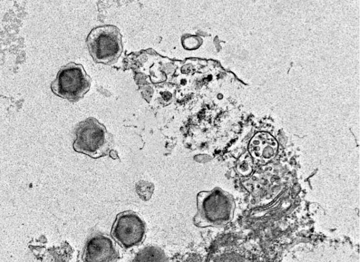 Scientists discover 230 new giant viruses that shape ocean life and ...