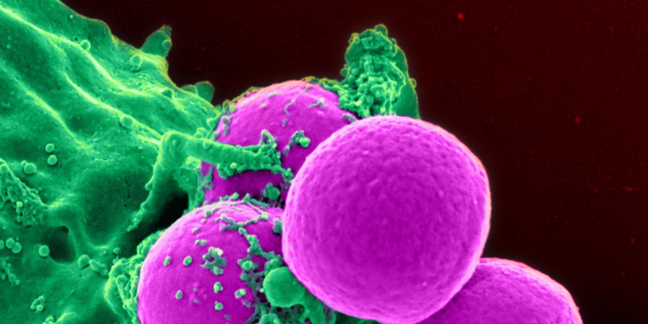 Under the microscope: the ESKAPE pathogens | Features | The Microbiologist