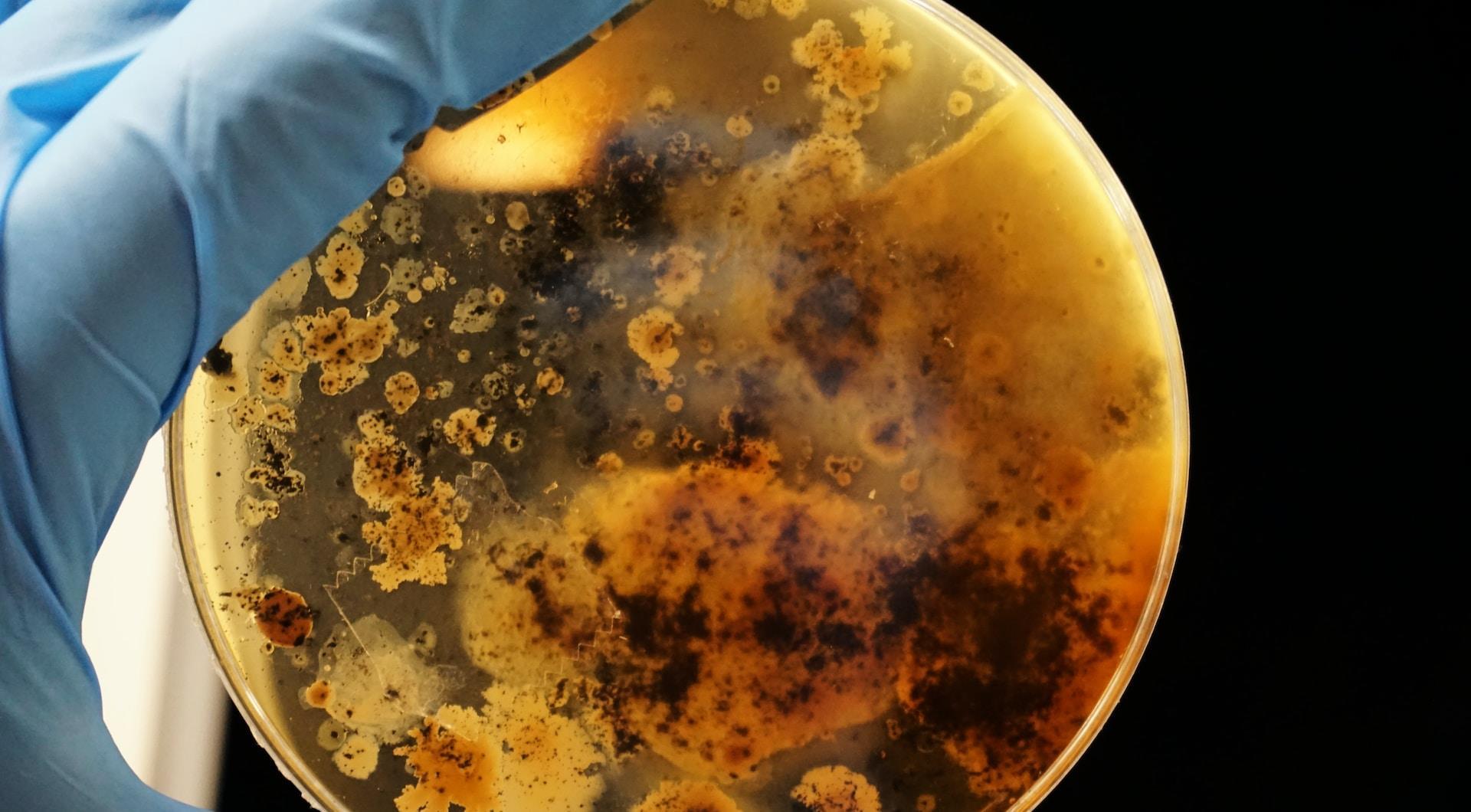 My placement year in antimicrobial research at The University of ...