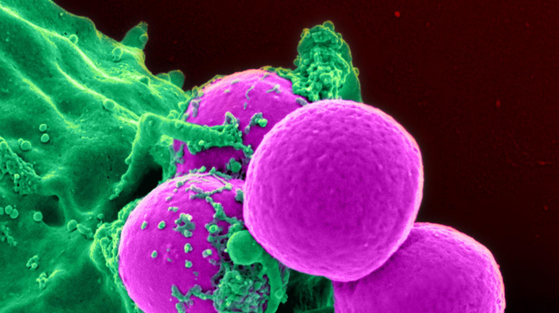 Under the microscope: the ESKAPE pathogens | Features | The Microbiologist