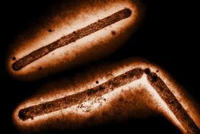 Under the microscope: rabies | Features | The Microbiologist