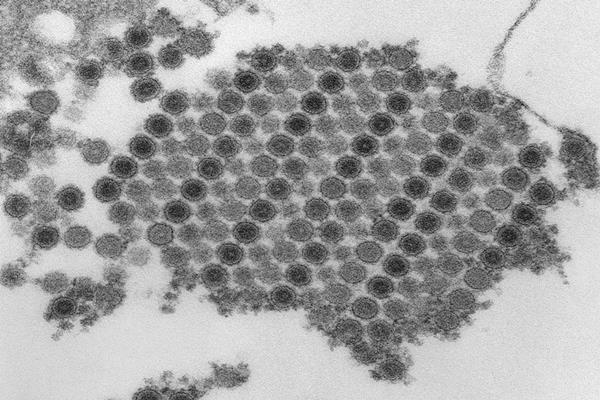 In rare cases, autoantibodies can cause severe reactions to a live ...