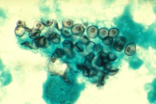 New tool shows how to enter and change pneumocystis fungi | News | The ...