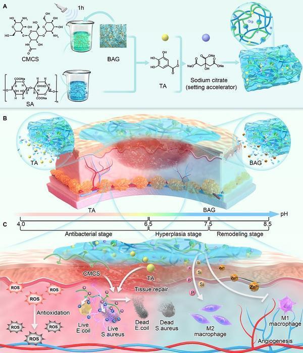 Microenvironment-feedback hydrogel enables precise staged repair of ...