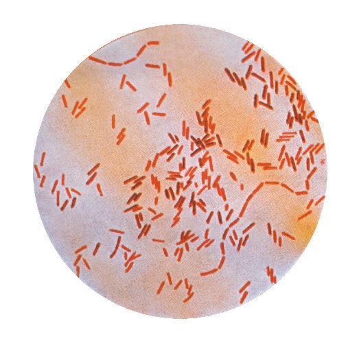 CARB-X to support development of typhoid fever diagnostic from Chembio ...
