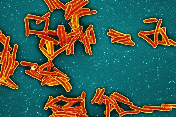 TB harnesses part of immune defense system to cause infection | News ...