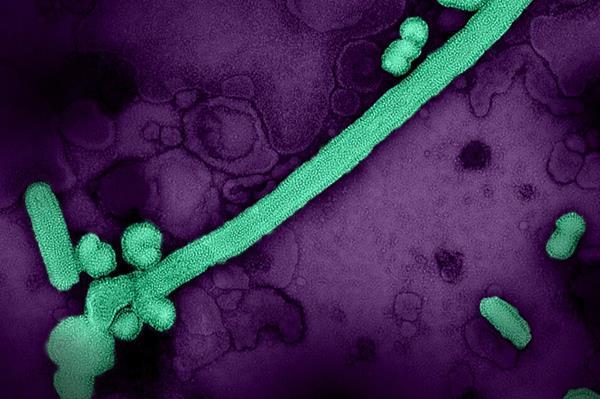 Gut bacteria protect mice with influenza A from bacterial pneumonia ...